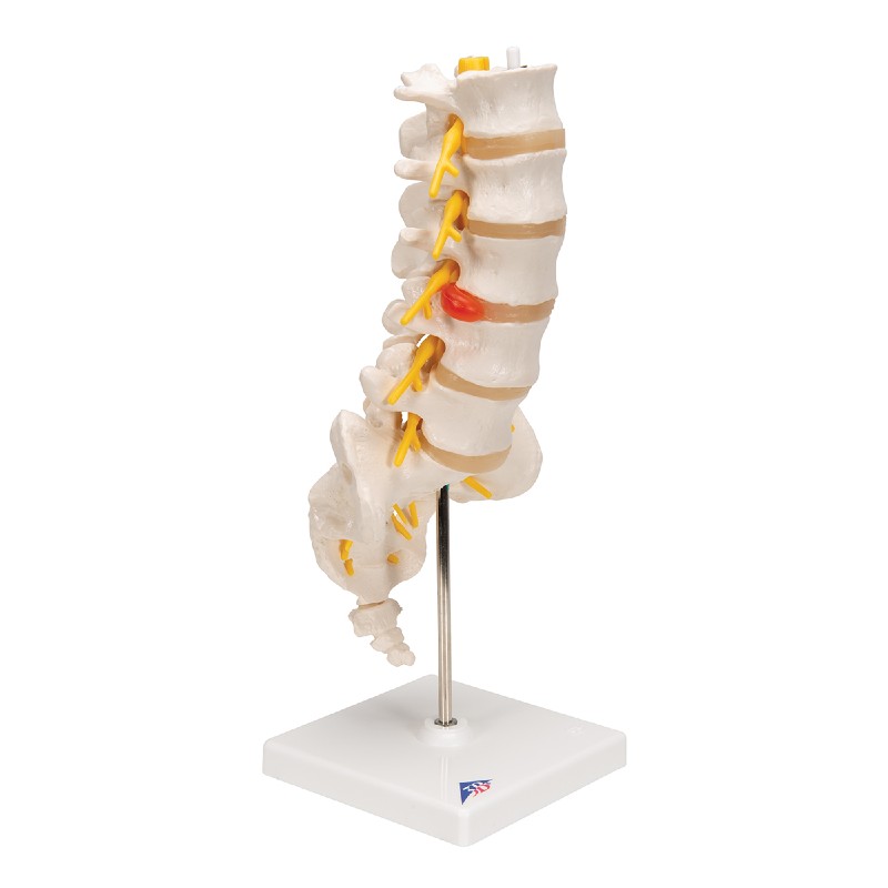 3B Scientific Lumbar Spine Model | Health and Care